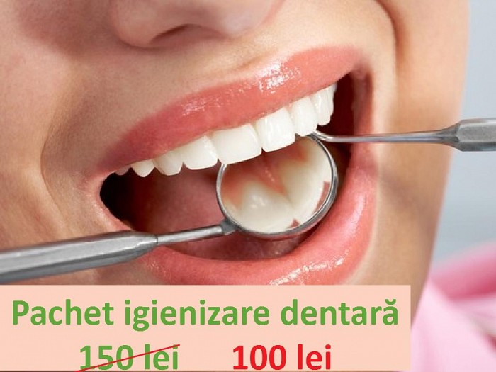 DETARTRAJ, PERIAJ SI FLUORIZARE | SERVICII STOMATOLOGICE
