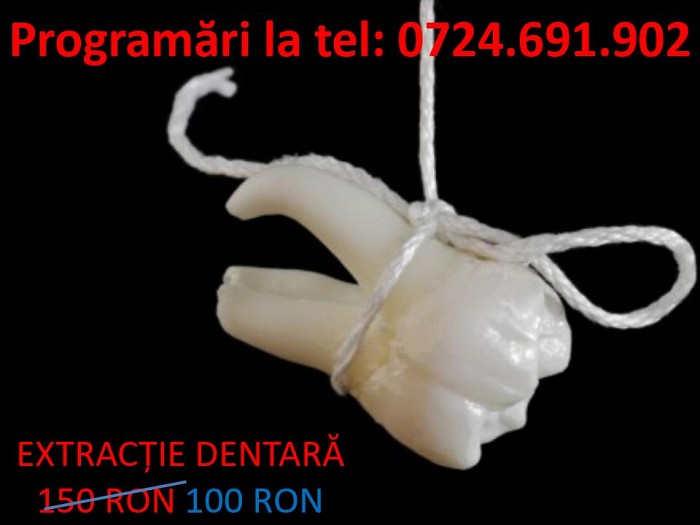 Extractie dentara! | SERVICII STOMATOLOGICE